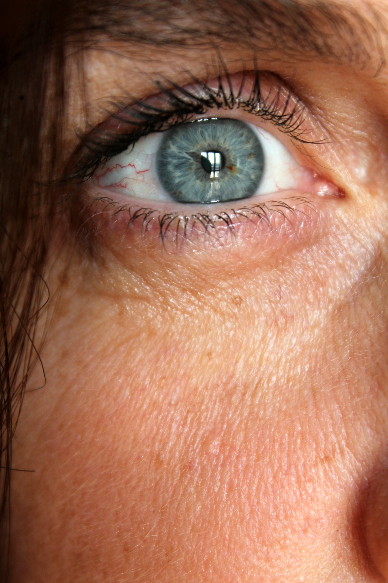 What Are The Physical Heroin Side Effects How To Treat Them